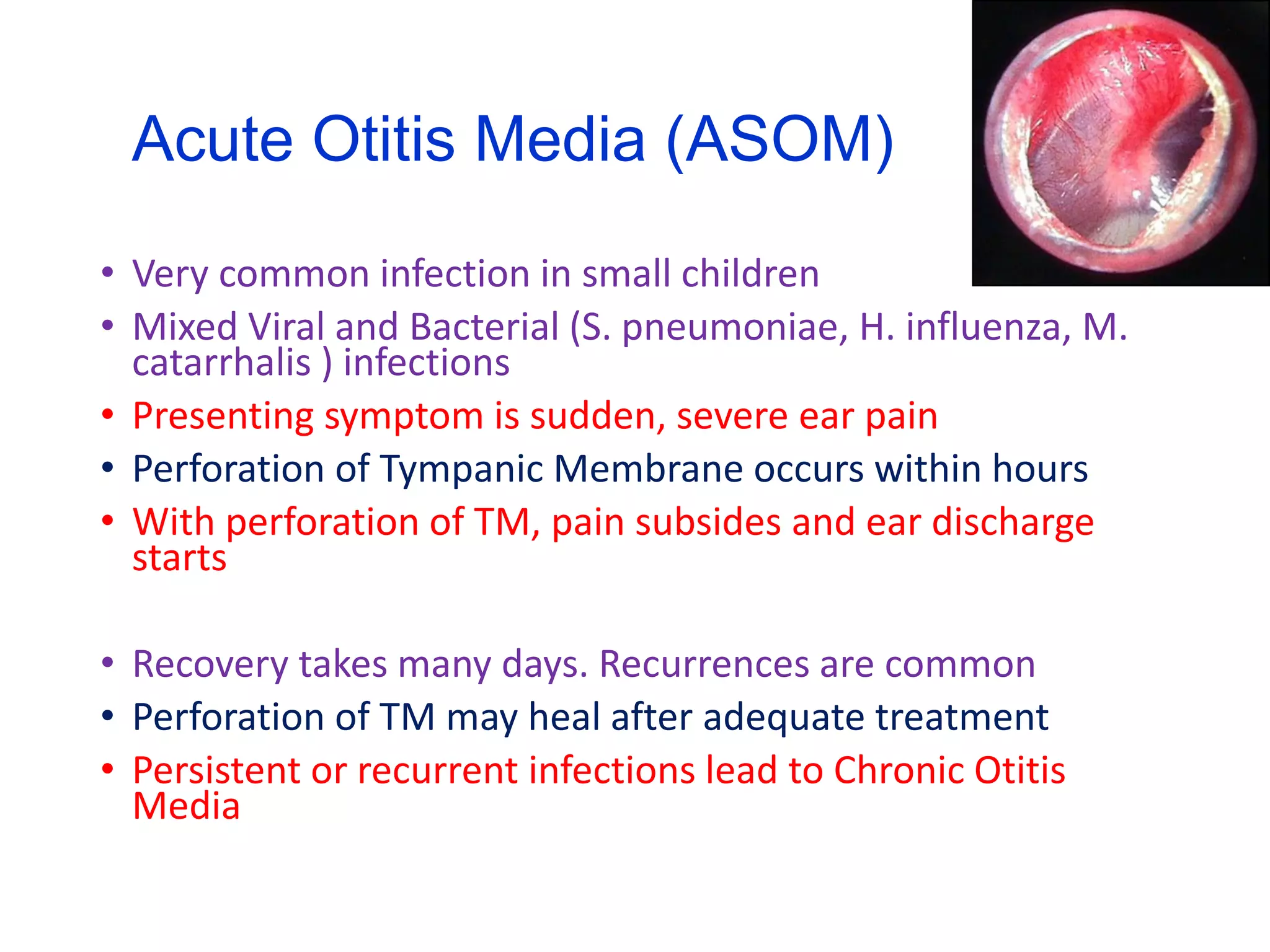 Acute respiratory infections 2021 | PDF