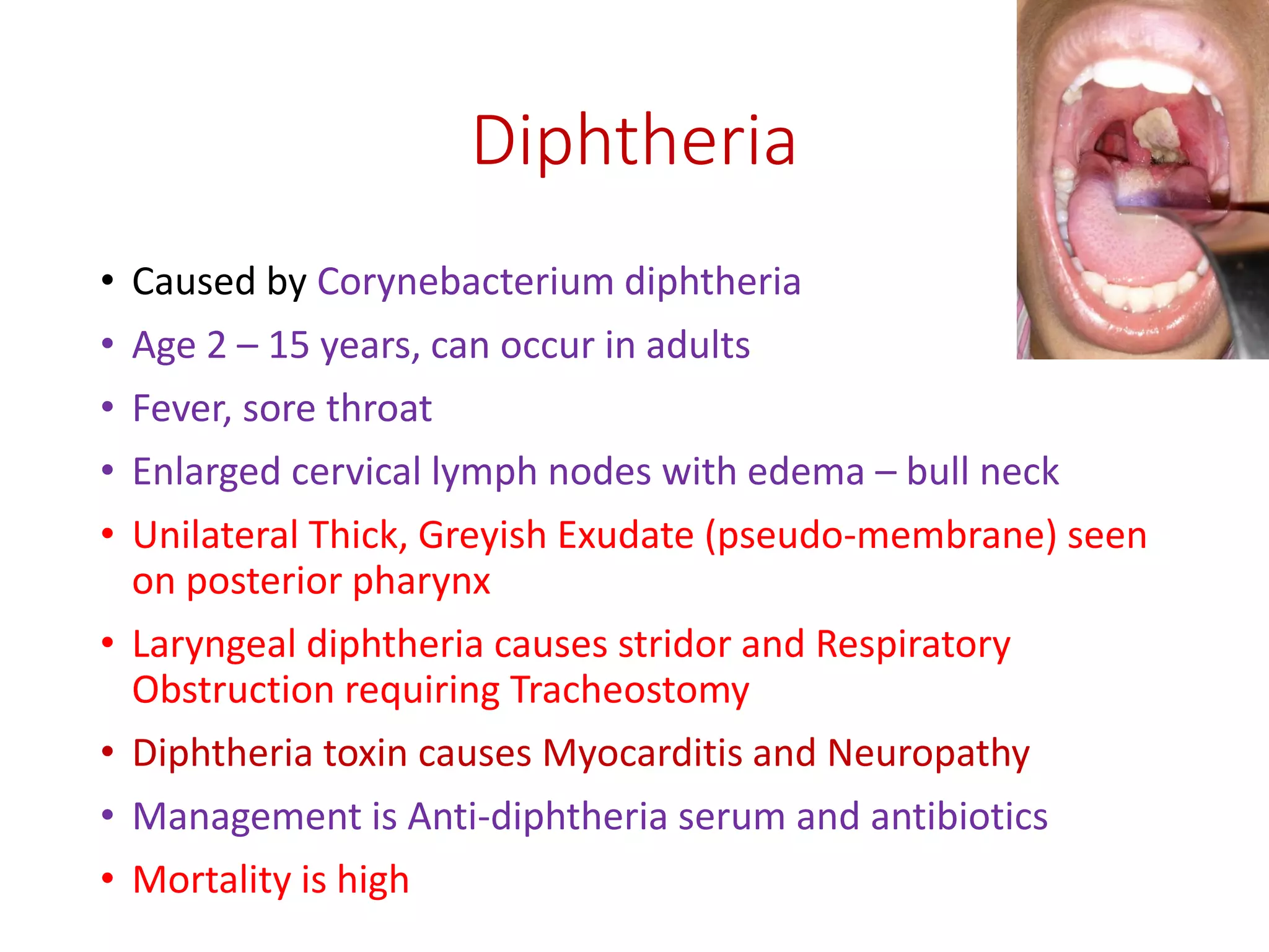 Acute respiratory infections 2021 | PDF