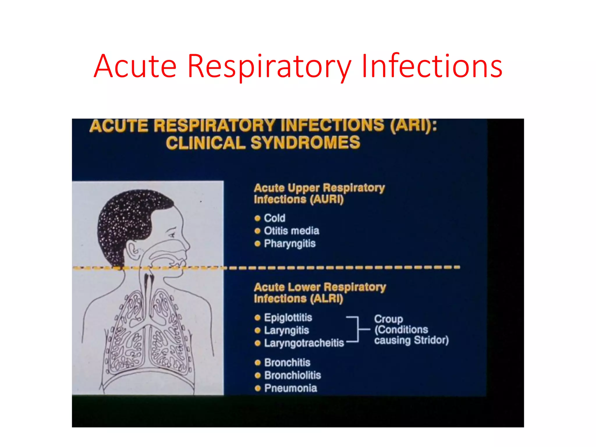Acute respiratory infections 2021 | PPT