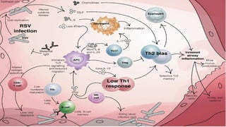 Acute respiratory infections (ARI) in children 2024-25.pptx