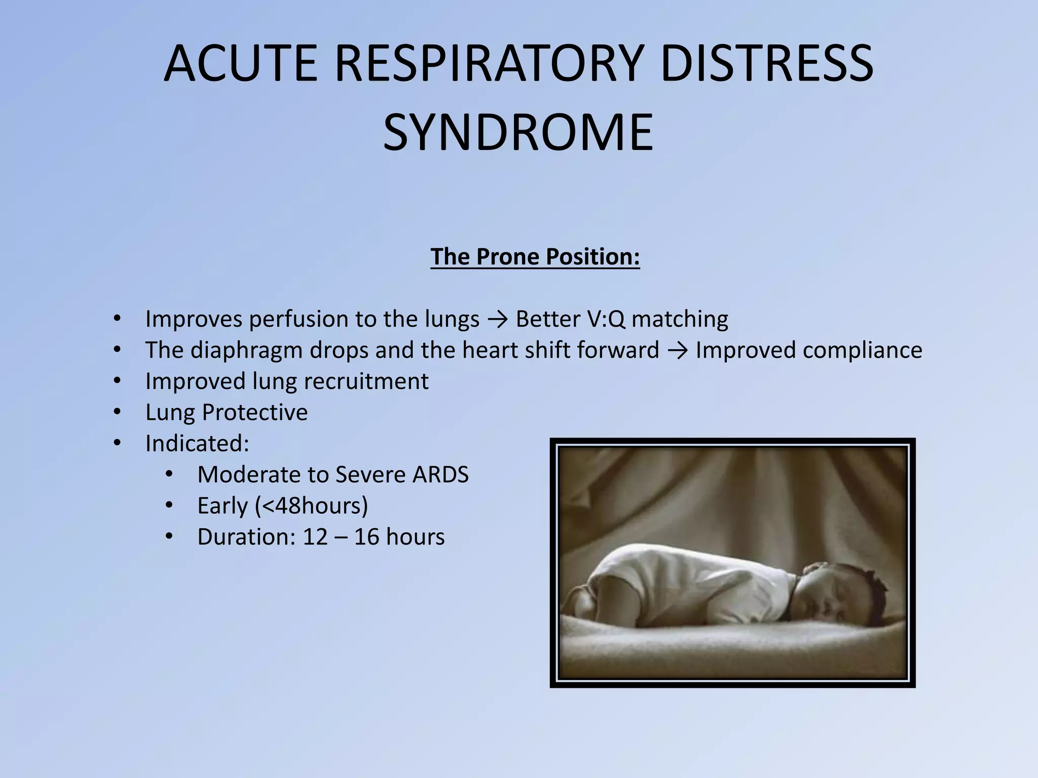 Acute Respirtaory Distress Syndrome | PPTX