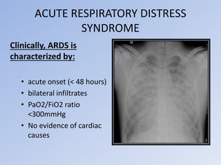 Acute Respirtaory Distress Syndrome | PPT