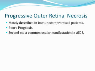 Acute retinal necrosis | PPTX