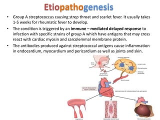 Acute rheumatic fever/ Rheumatic Fever | PPTX