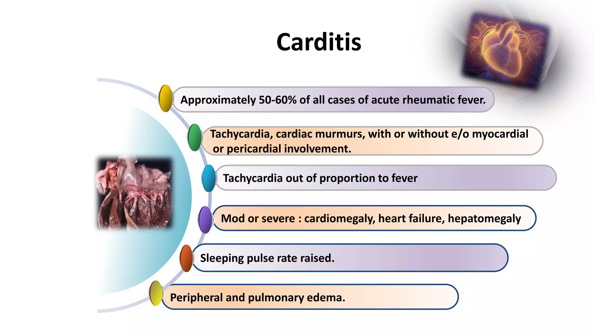 Acute rheumatic fever in Children | PPTX