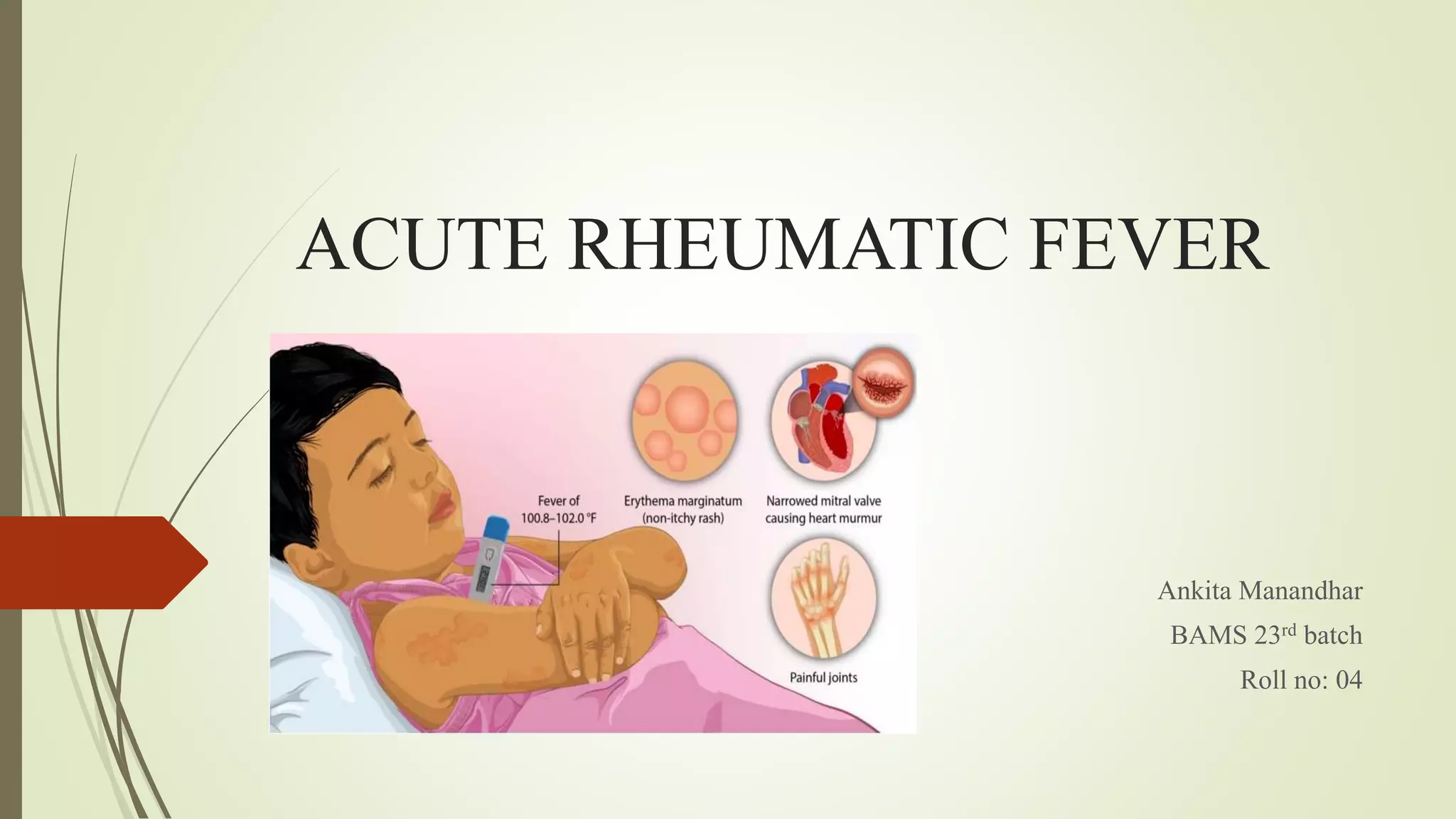 ACUTE RHEUMATIC FEVER.pptx
