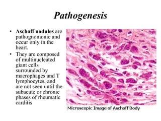 Acute rheumatic fever.ppt