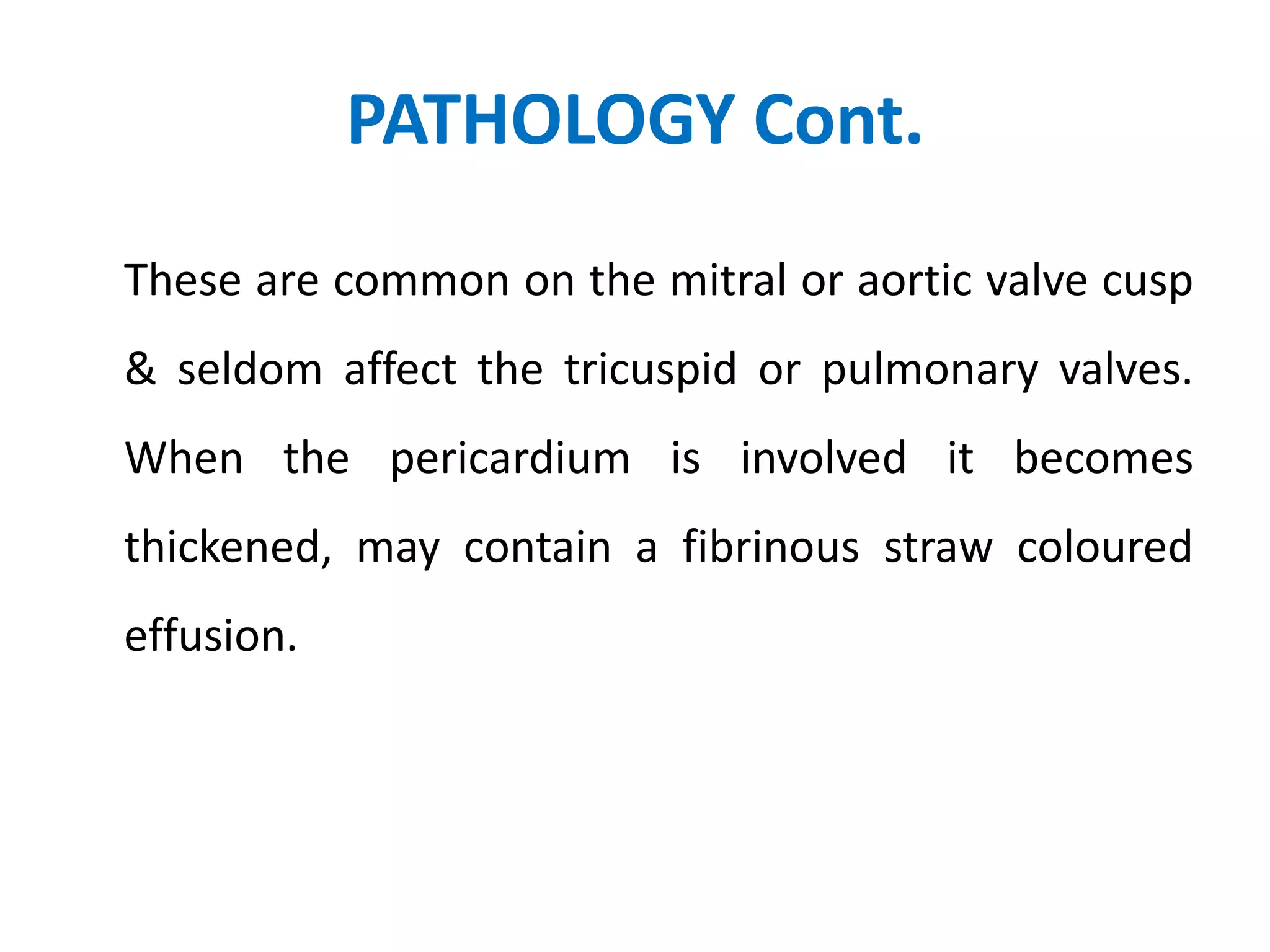 Acute Rheumatic Fever.ppt