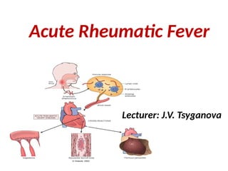acute_rheumatic_fever therapy, cardiology | PPTX