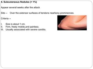 Acute Rheumatic Fever (ARF).ppt.pptx