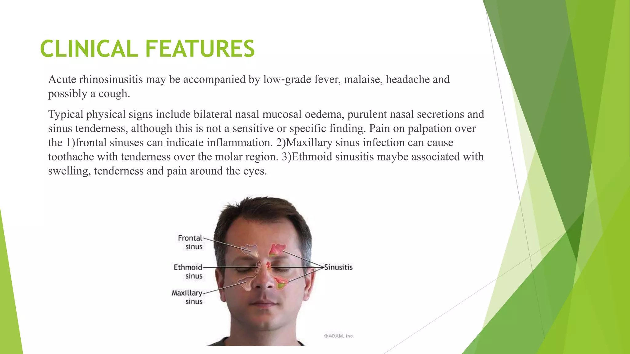 Acute rhinosinusitis | PPTX