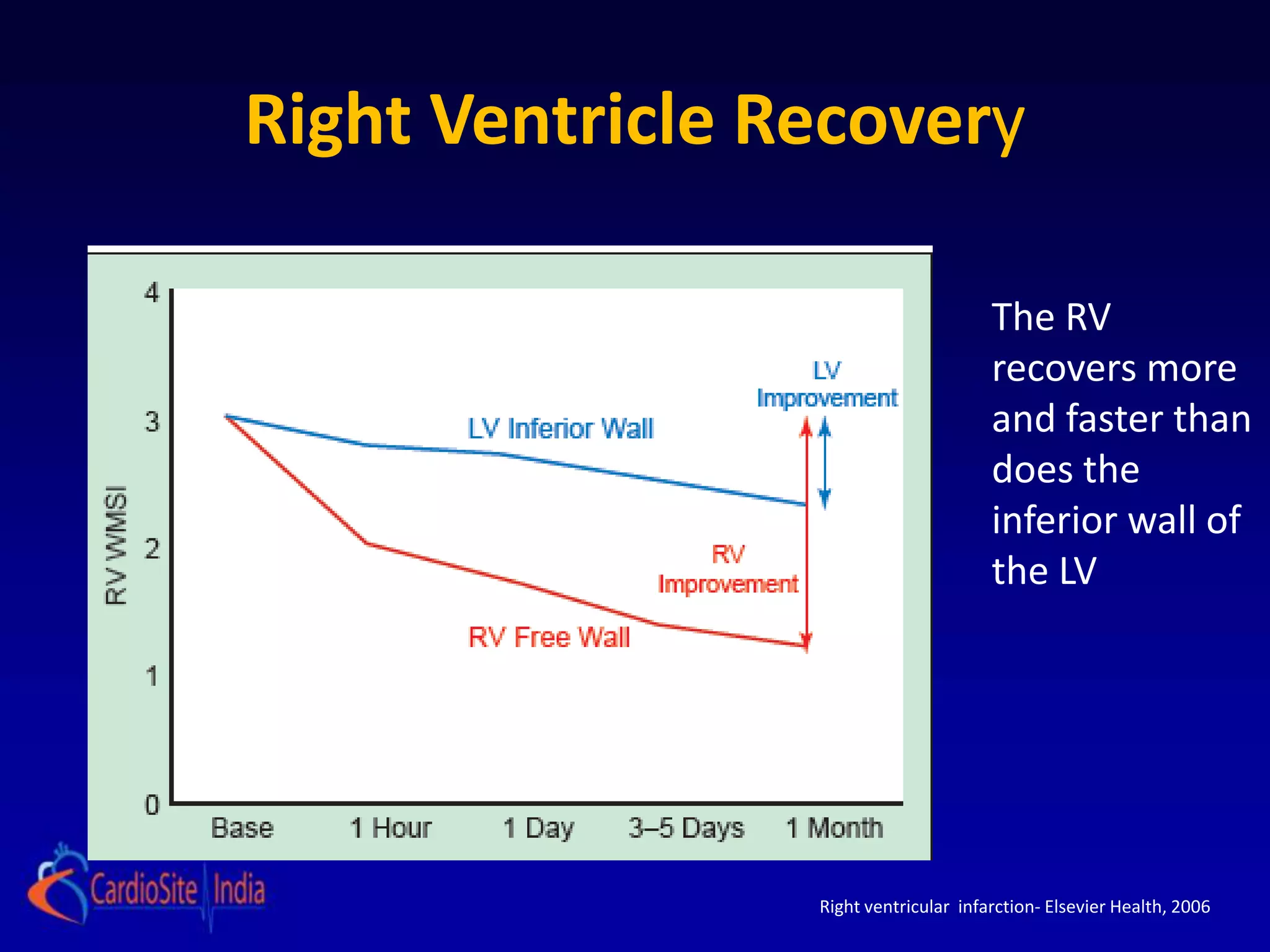 Acute rv failure physiology to management | PPT
