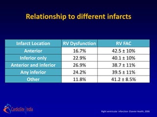 Acute rv failure physiology to management | PPT