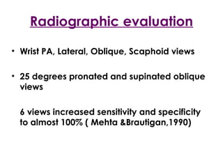 Acute scaphoid fractures | PPT