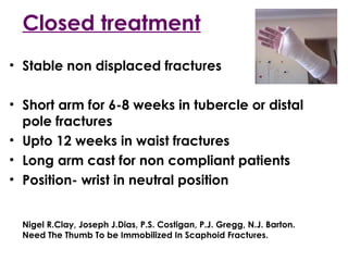 Acute scaphoid fractures | PPT