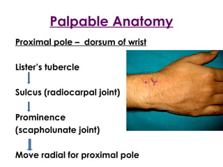 Acute scaphoid fractures | PPT