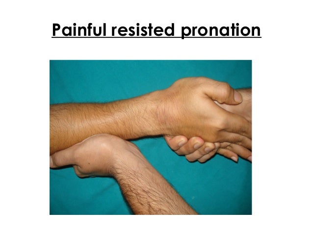 Acute scaphoid fractures