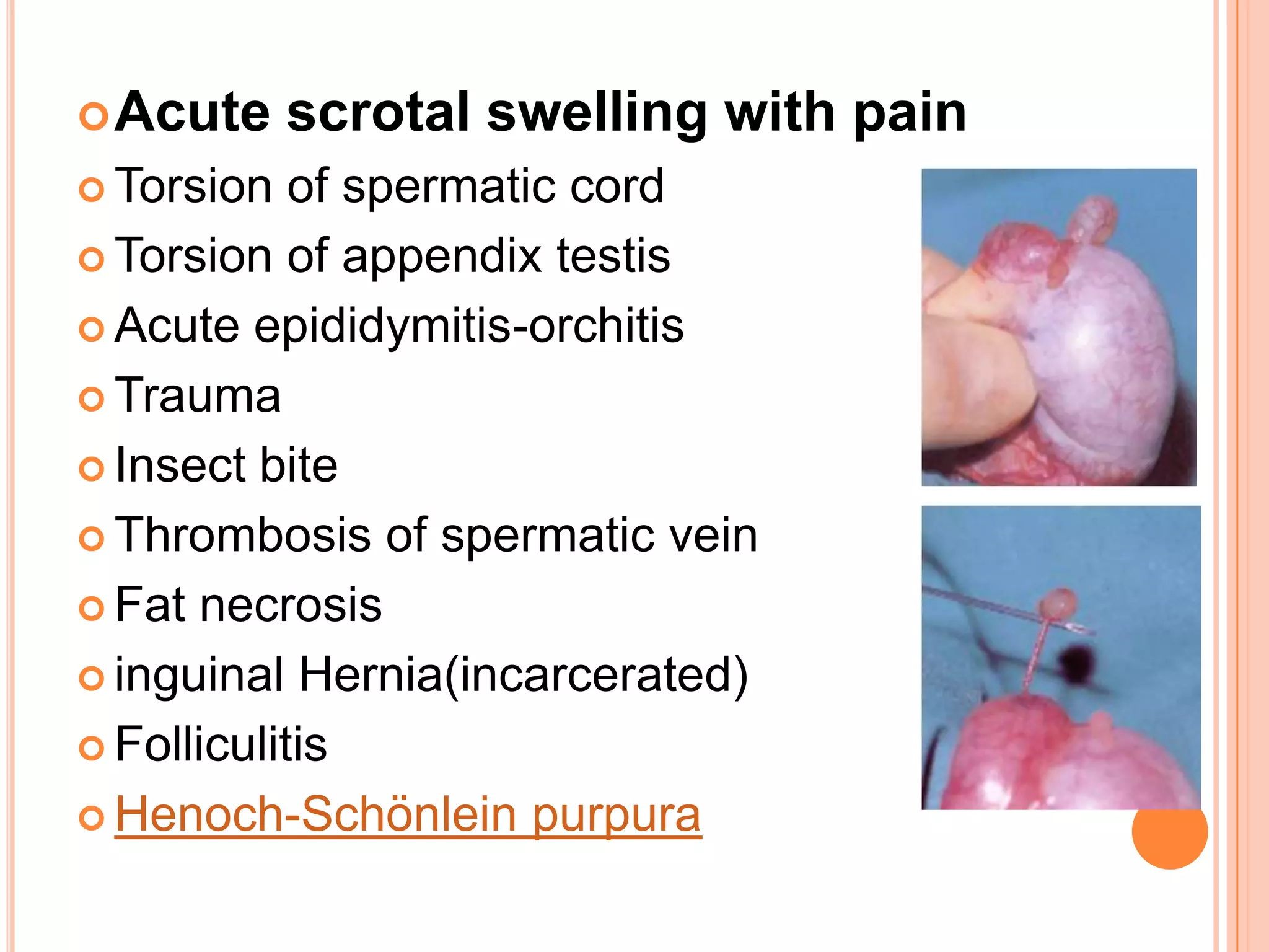 Acute scrotal swelling and pain in children1 | PPTX