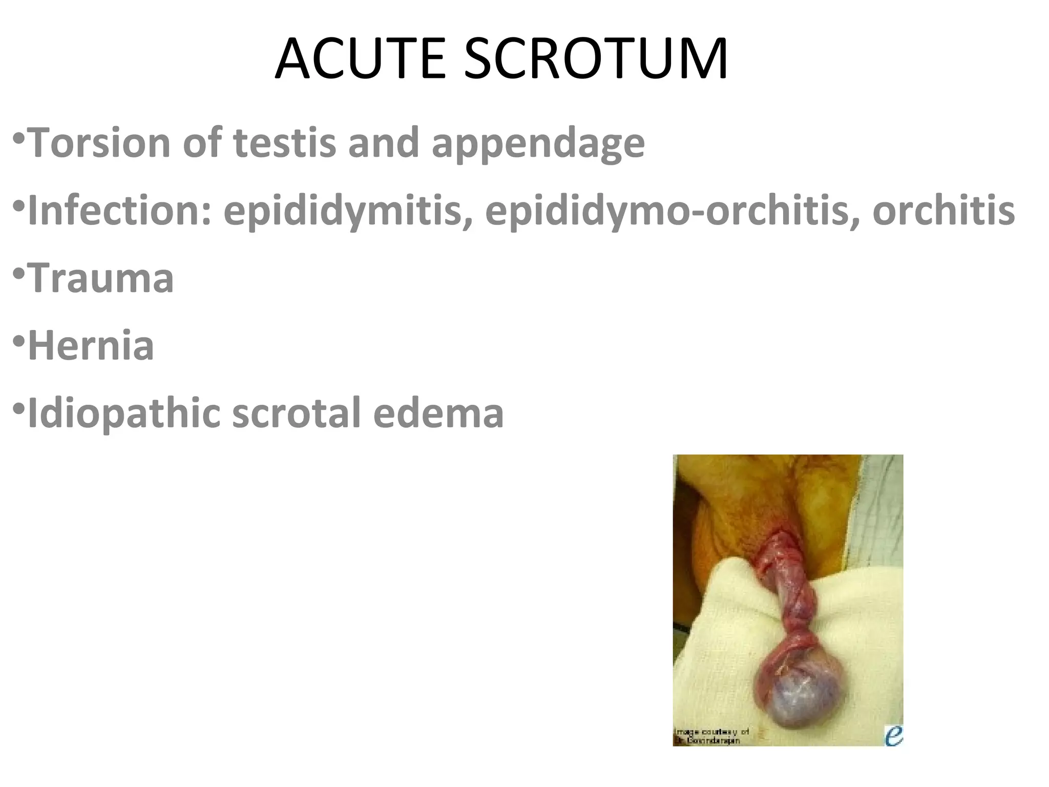 Acute scrotum | PPT