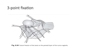 acute scrotum, a discussion by urologist | PPT