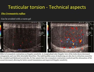 Acute scrotum (1).pptx