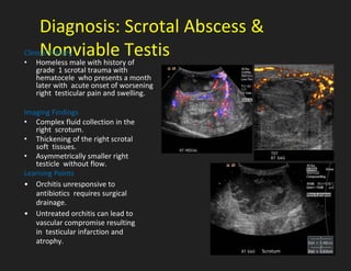 Acute scrotum (1).pptx