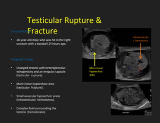 Acute scrotum (1).pptx