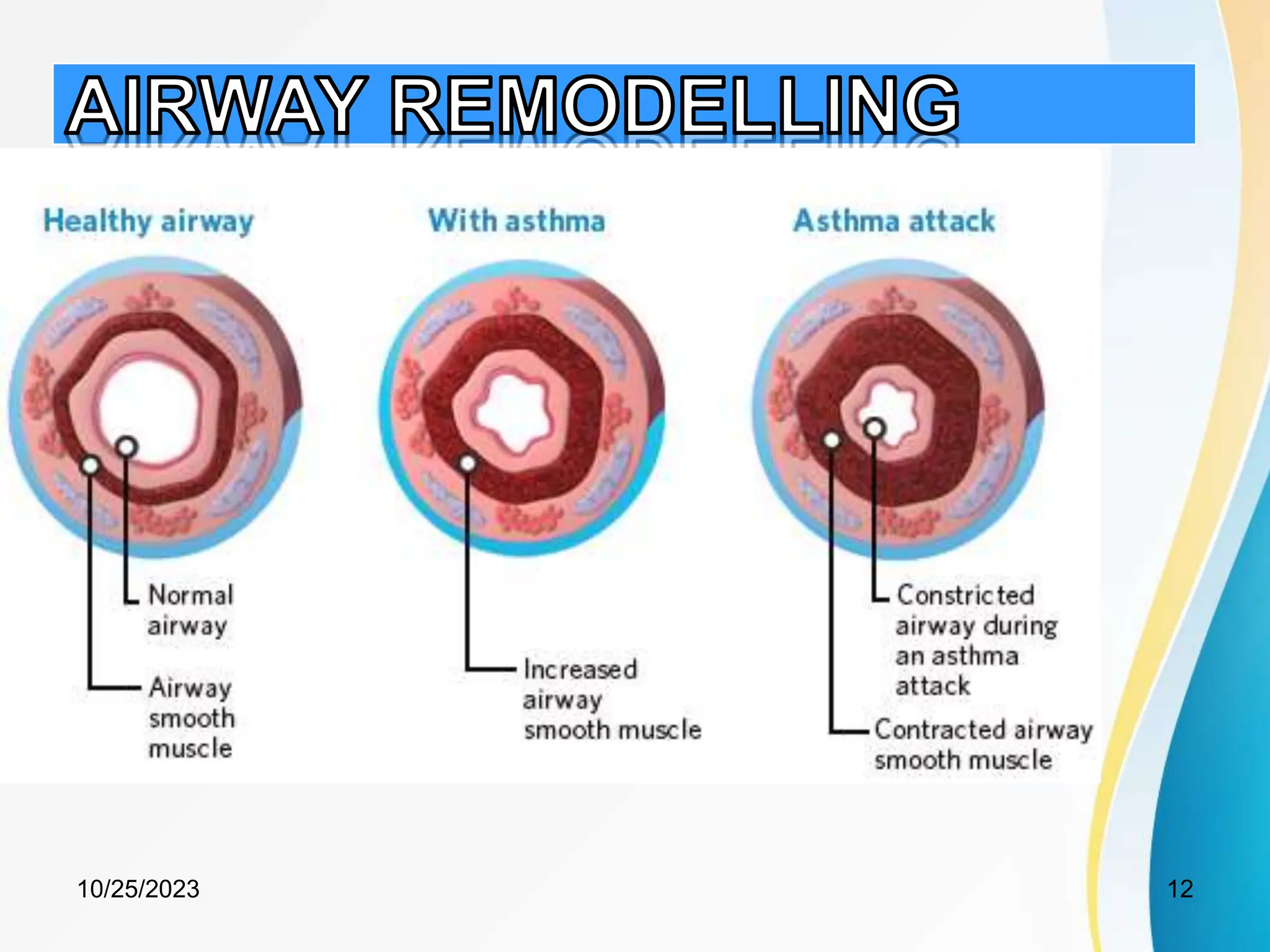 Acute Severe Asthma.pptx