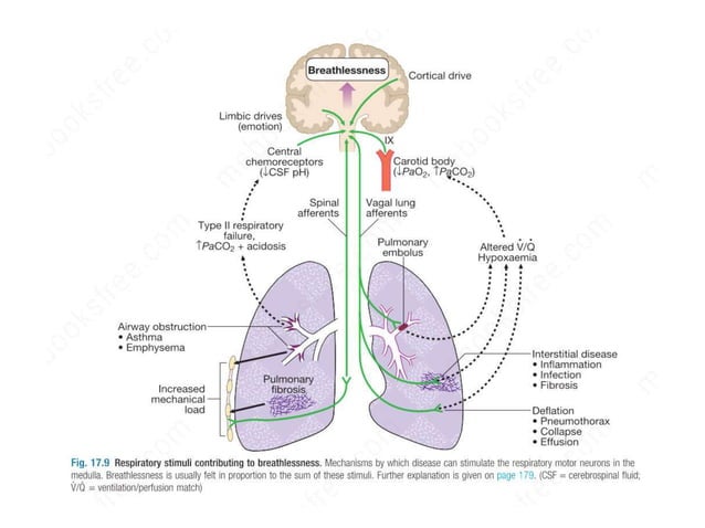 Approach to Acute shortness of breath | PPTX