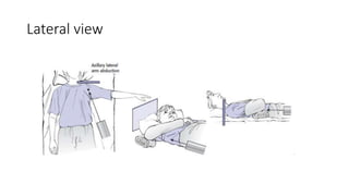 Acute shoulder dislocation | PPTX