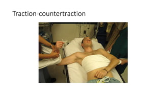 Acute shoulder dislocation | PPTX