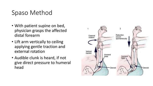 Acute shoulder dislocation | PPTX | Death, Injury, or Military Conflict ...