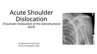 Acute Shoulder Dislocation (Traumatic Dislocation of the Glenohumeral ...