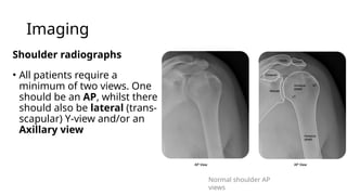 Acute Shoulder Dislocation (Traumatic Dislocation of the Glenohumeral ...