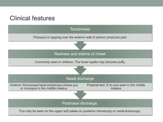ACUTE SINUSITIS | PPTX
