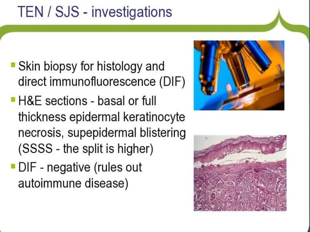 Acute skin failure | PPTX | Skin and Dermatology | Diseases and Conditions