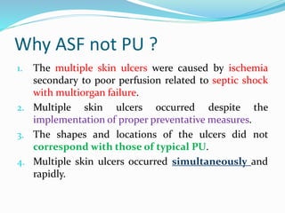 Acute skin failure | PPTX