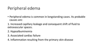 acute skin failure.pptx