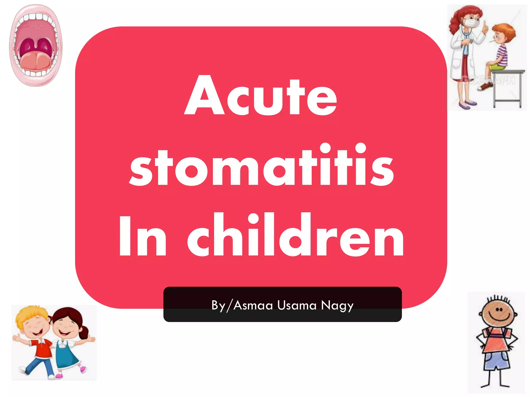 Acute stomatitis in children | PDF