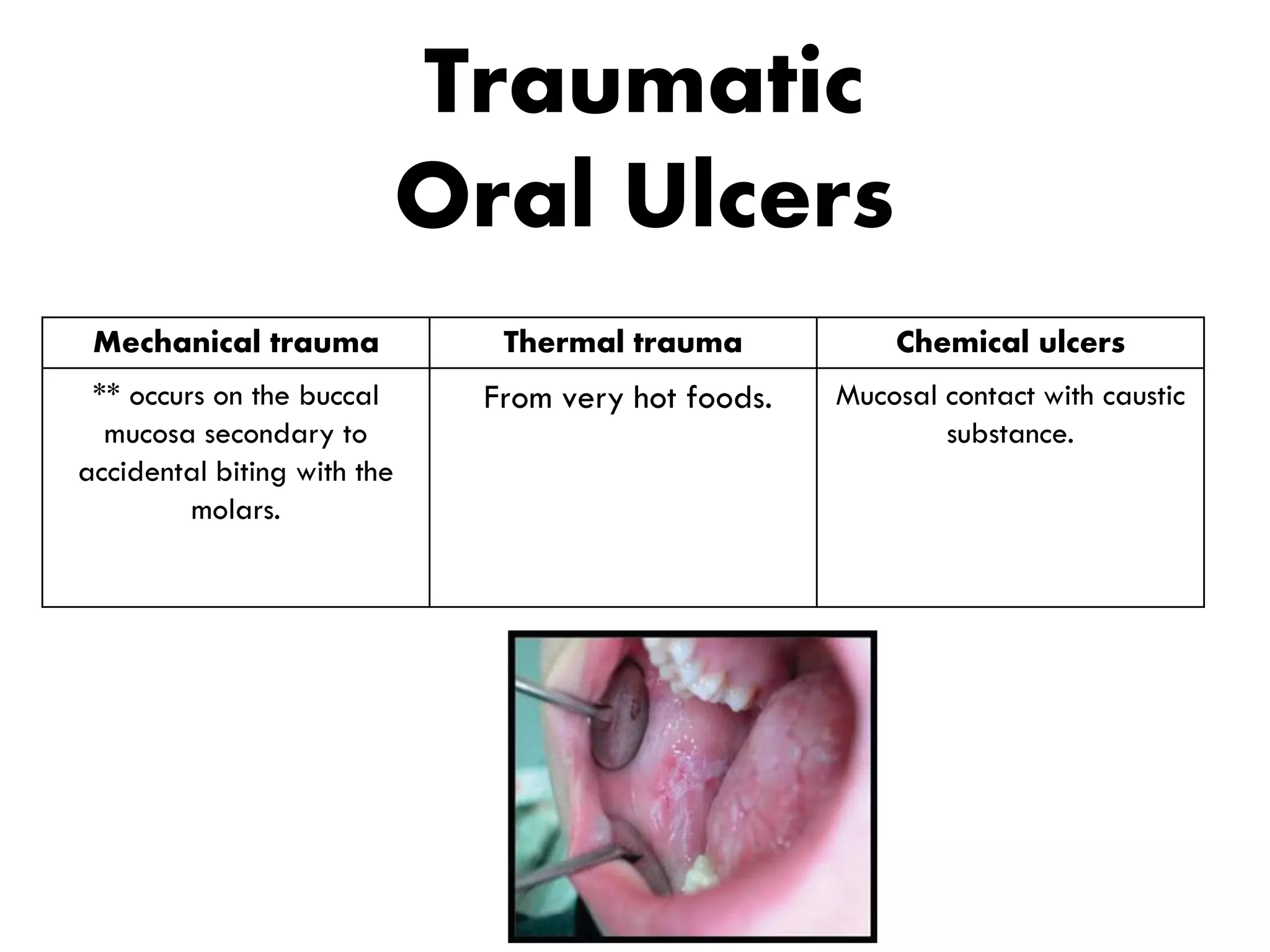 Acute stomatitis in children | PDF