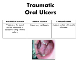 Acute stomatitis in children | PDF