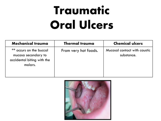 Acute stomatitis in children | PDF | Dental Health | Diseases and ...