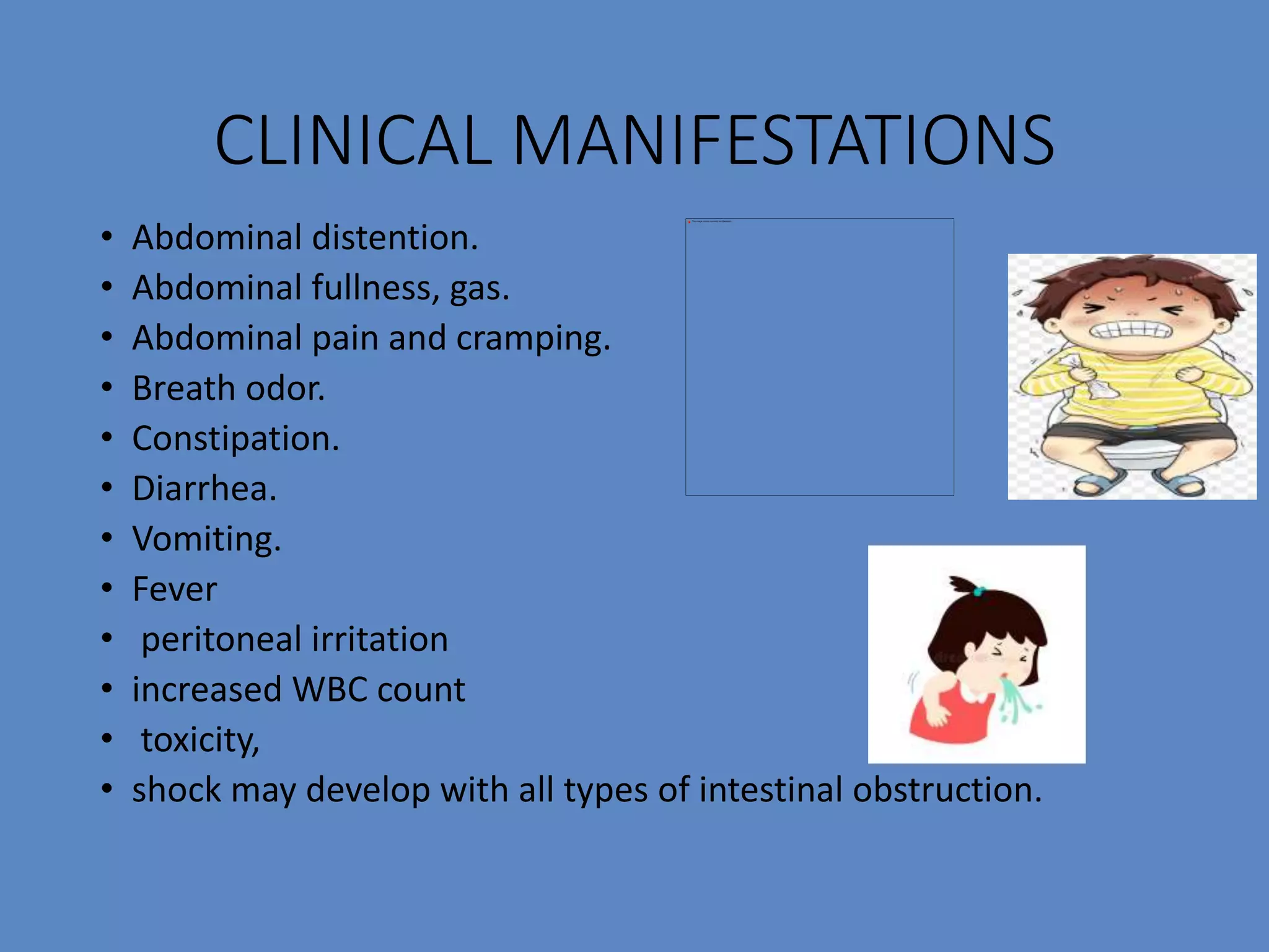 acute Strangulated Intestinal Obstruction -Bhadra.pptx