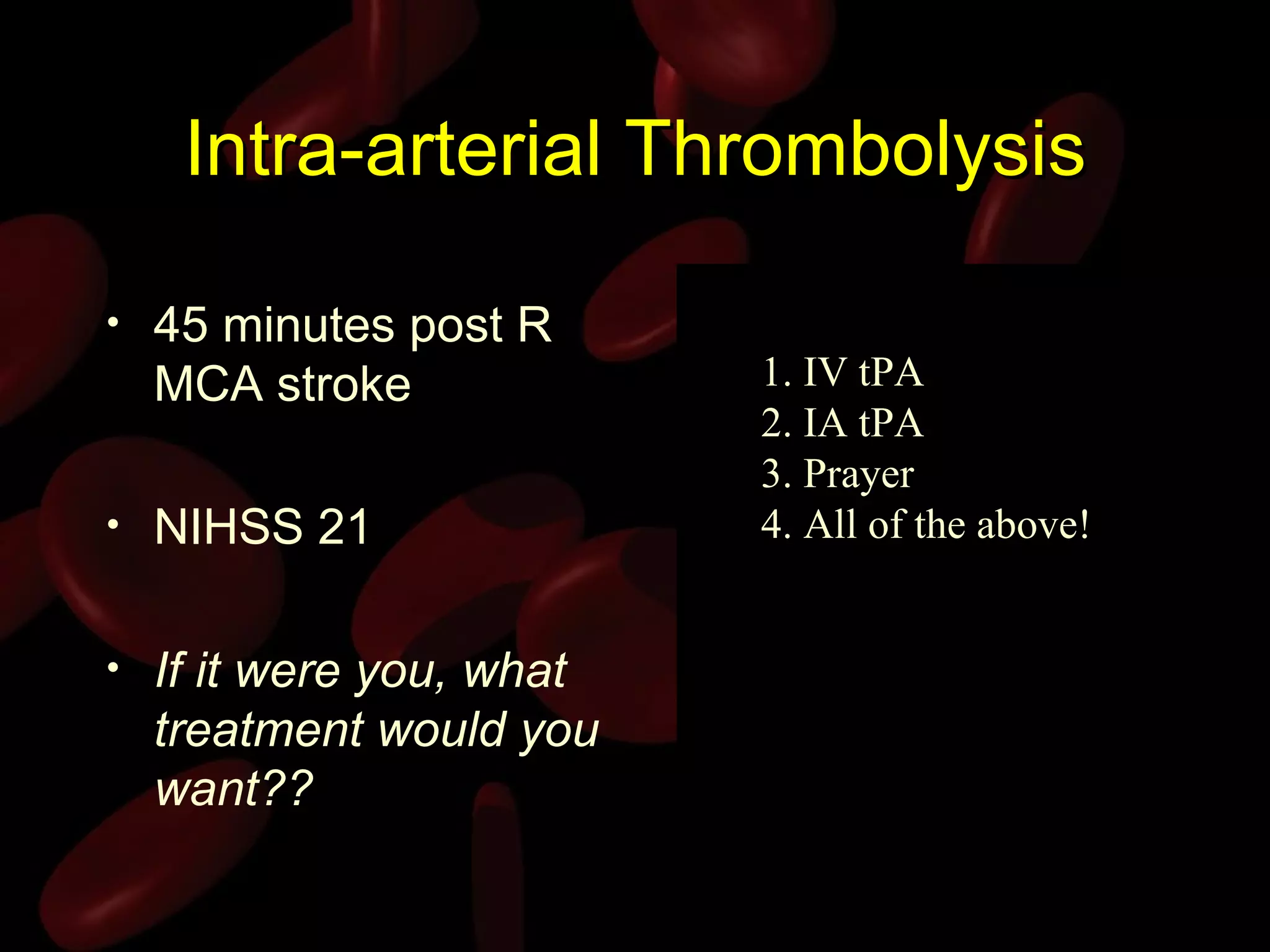 Acute Stroke Management Handouts Power Point885 | PPT