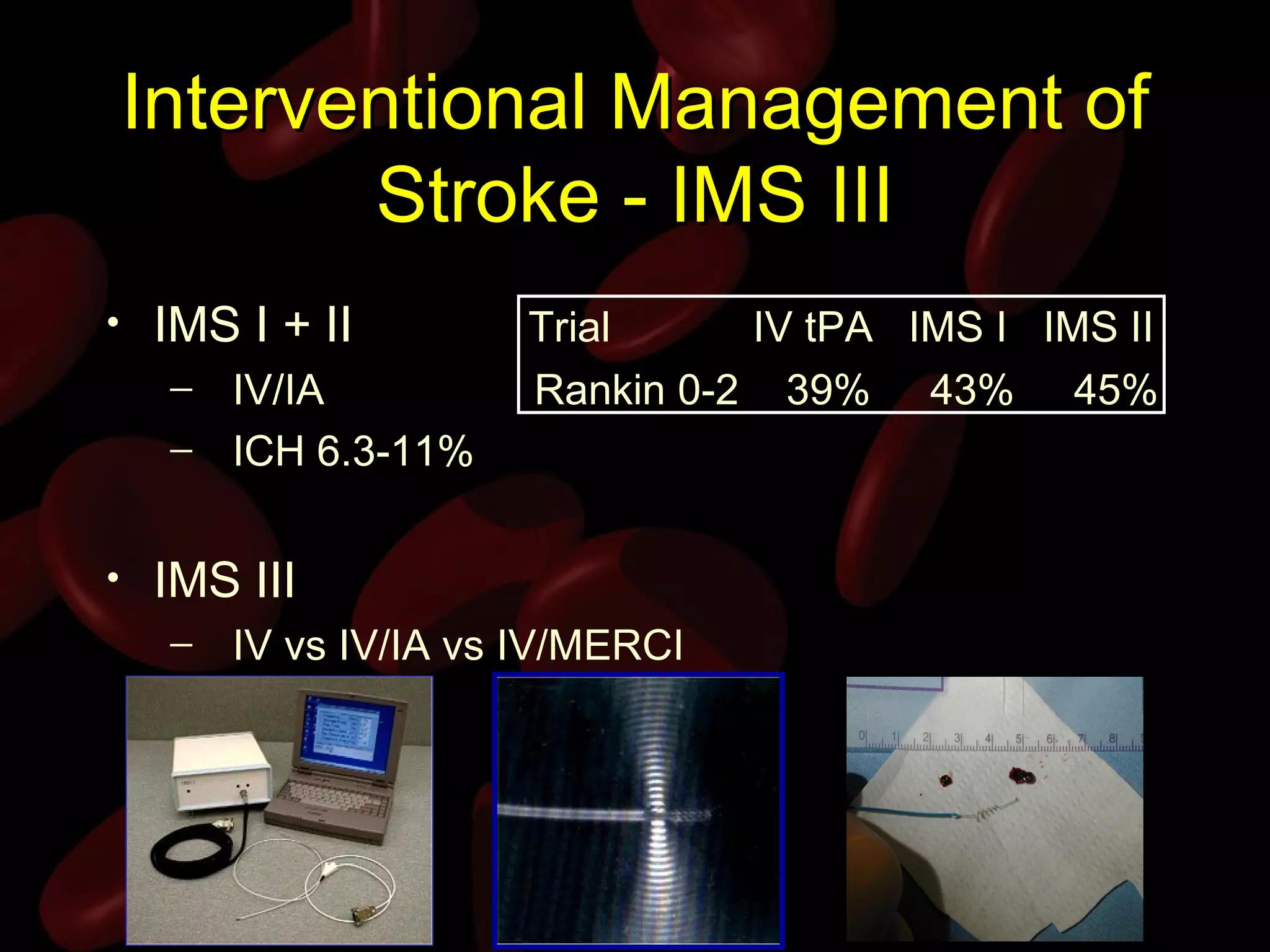 Acute Stroke Management Handouts Power Point885 | PPT