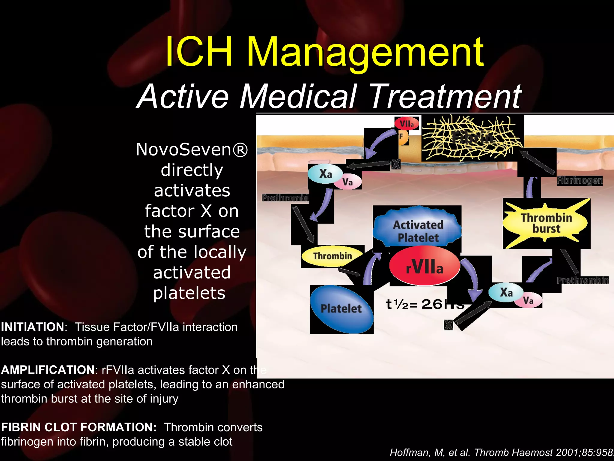 Acute Stroke Management Handouts Power Point885 | PPT