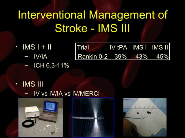 Acute Stroke Management Handouts Power Point885 | PPT