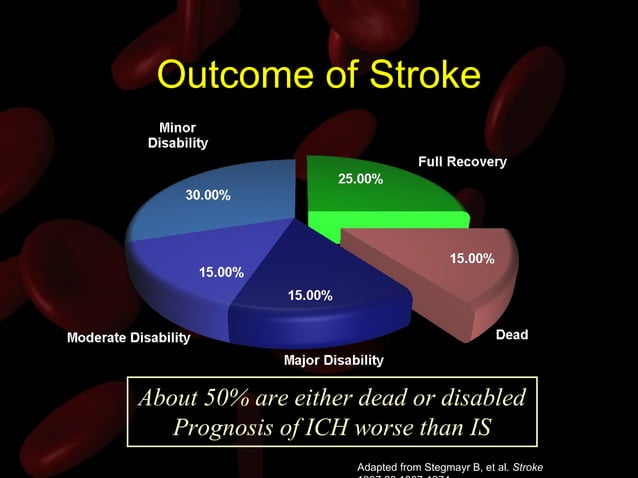 Acute Stroke Management Handouts Power Point885 | PPT