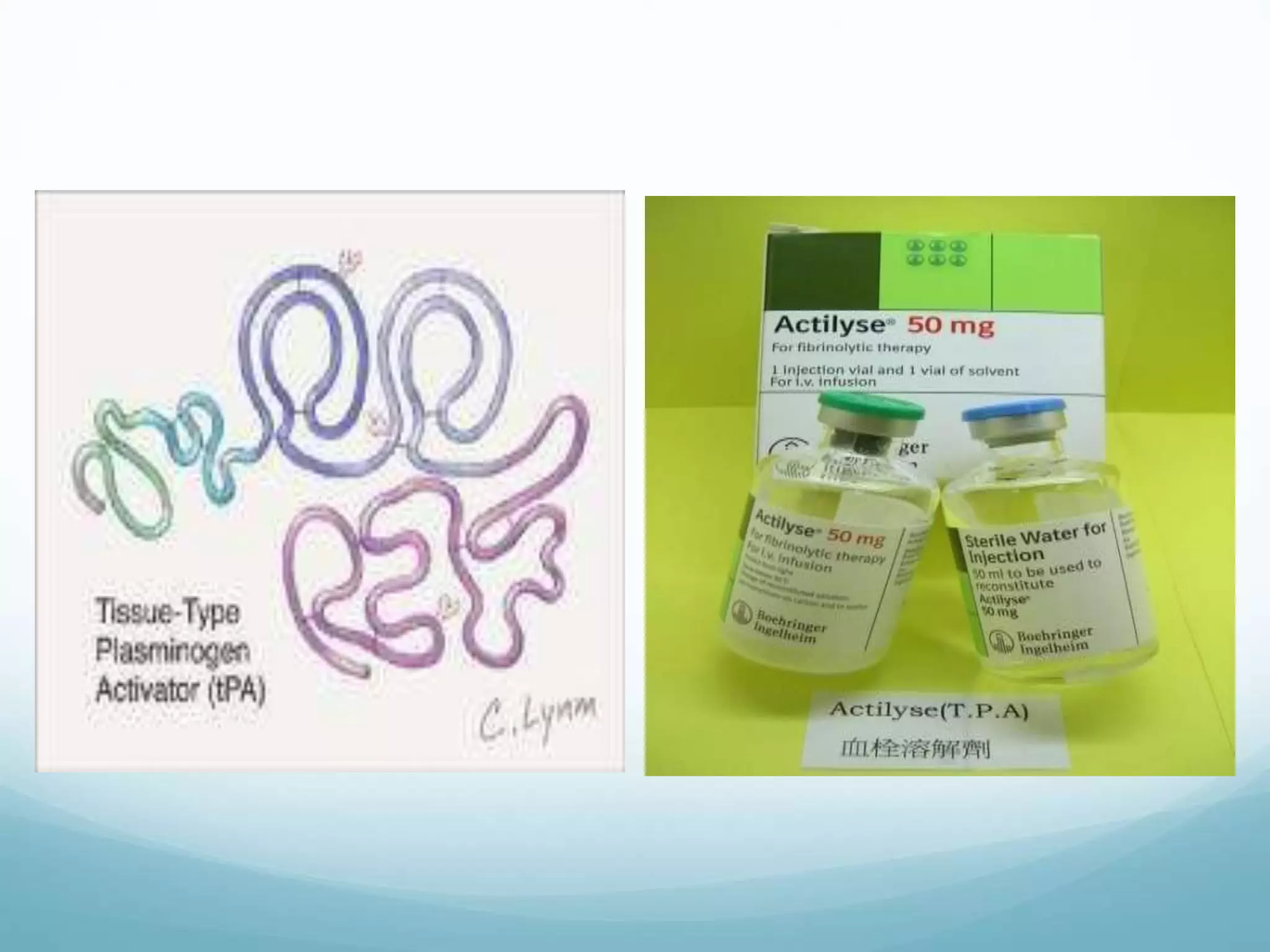 Acute Ischaemic Stroke Mx SCGH - ED Update | PPT