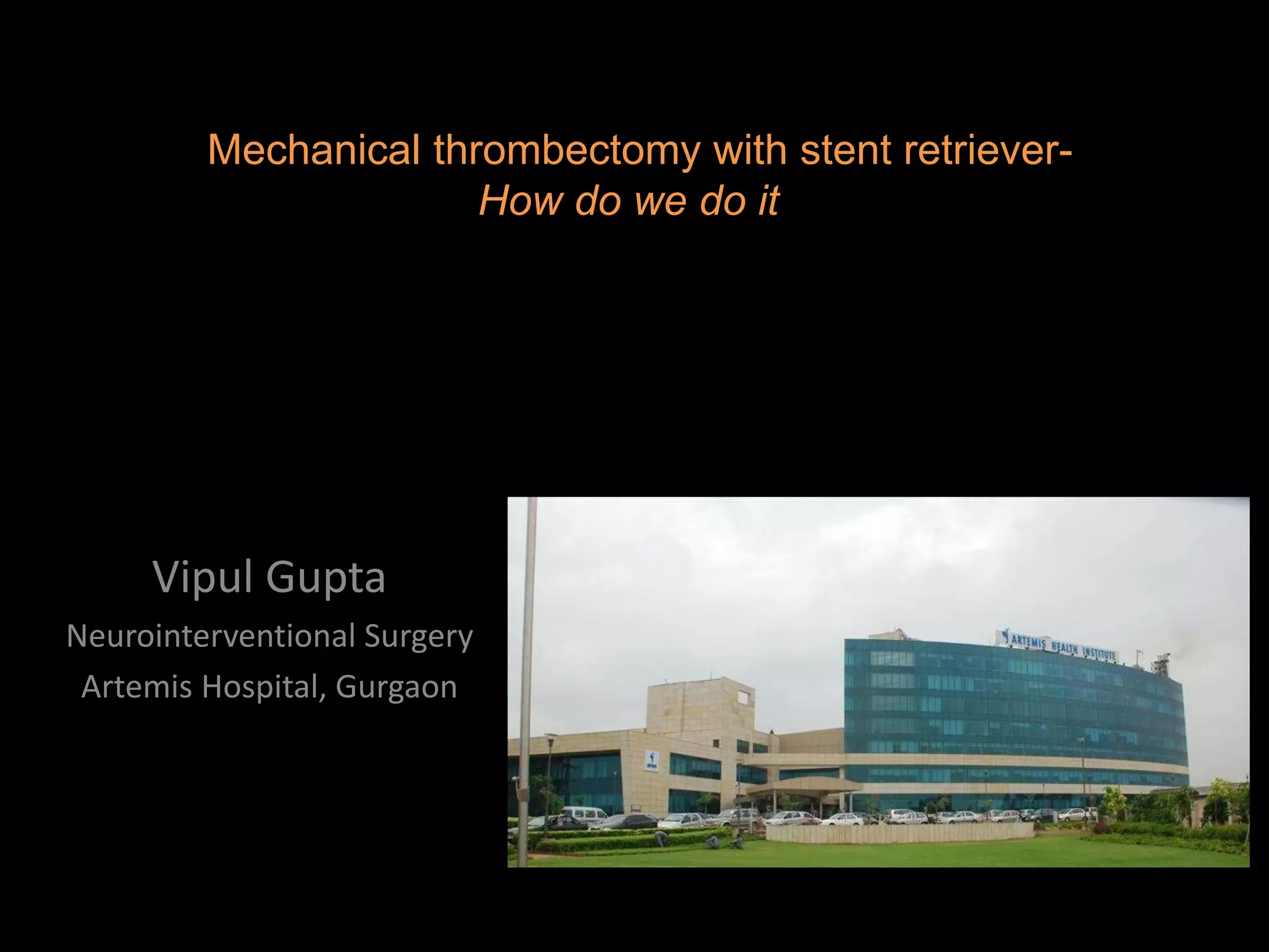 Mechanical thrombectomy with stent retriever | PPTX